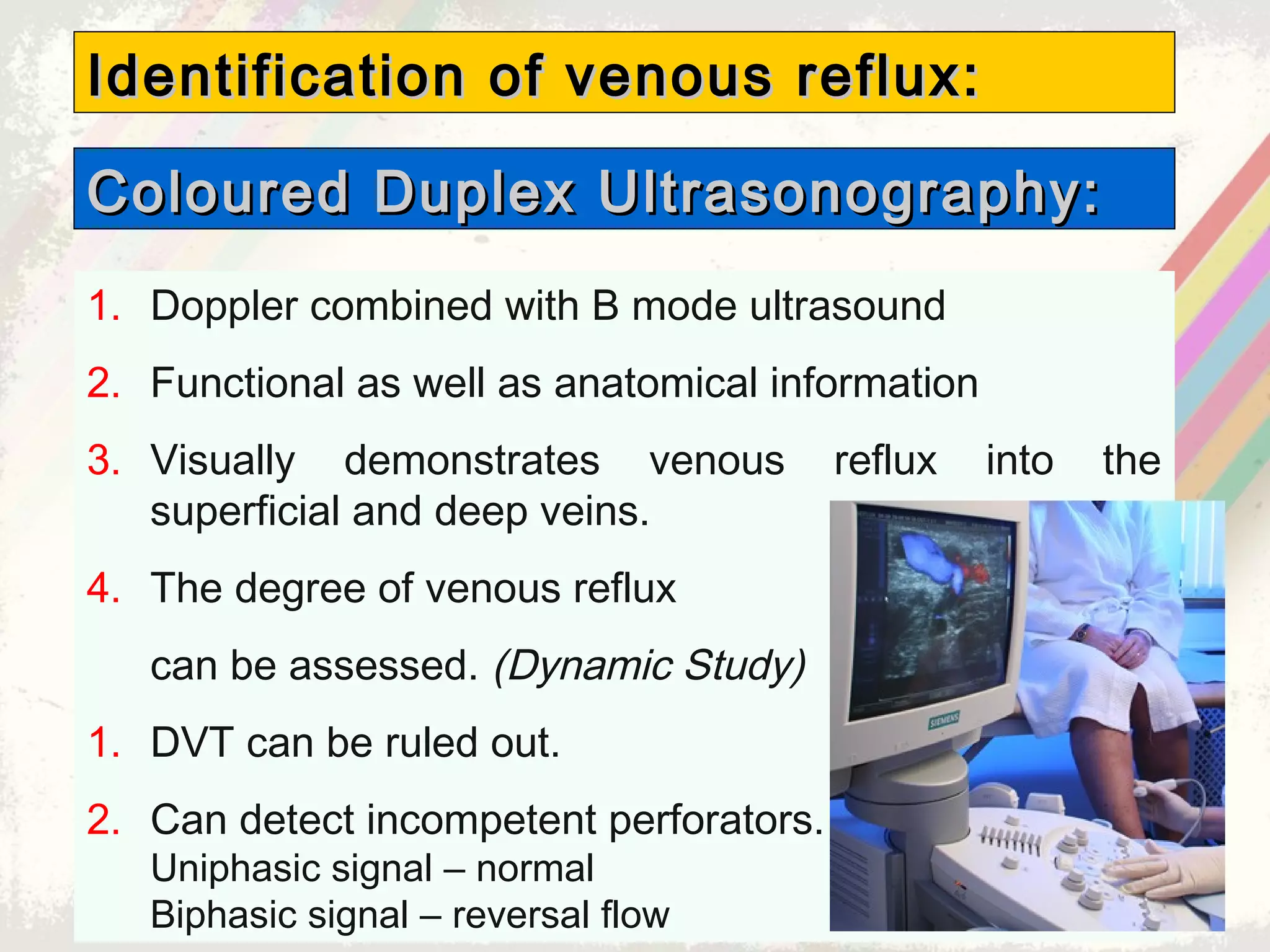Varicose veins | PPT