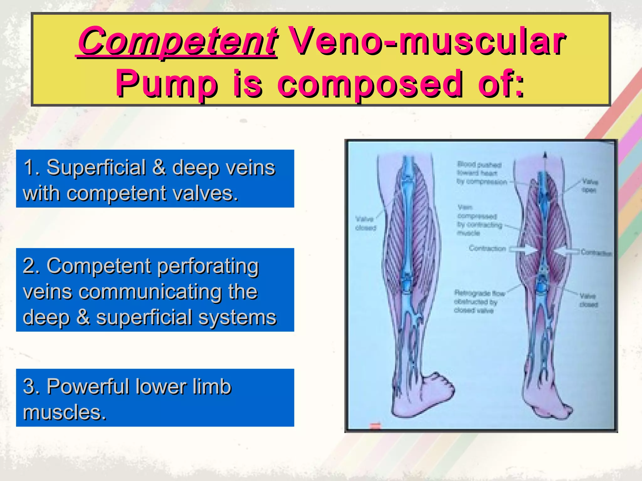 Varicose veins | PPT