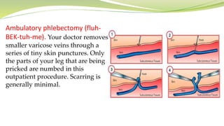 Varicose veins (medical information) causes, manag, risk factors ...