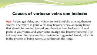 Varicose veins (medical information) causes, manag, risk factors ...