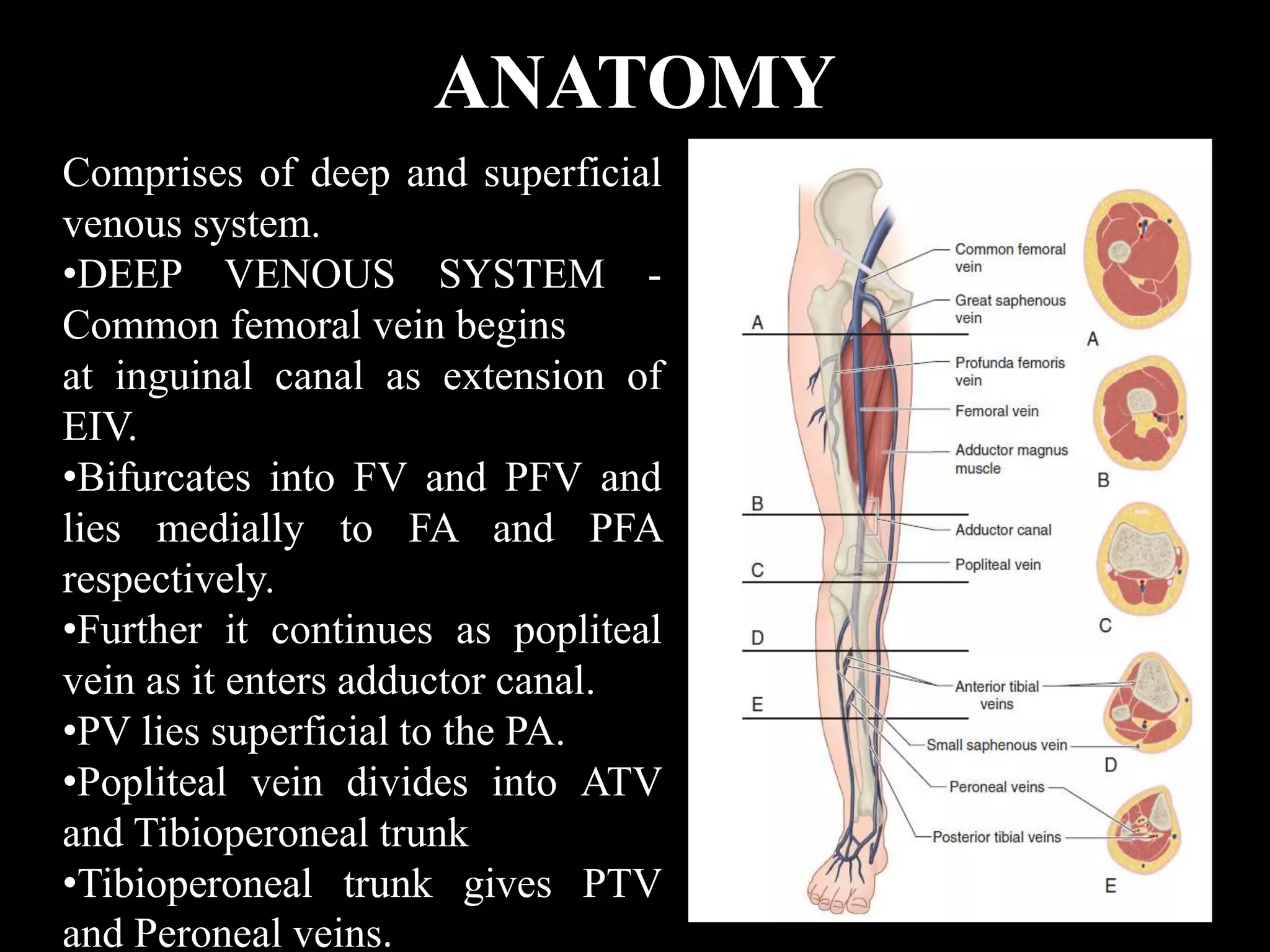 Diagnosis and radiological management of varicose vein | PPTX