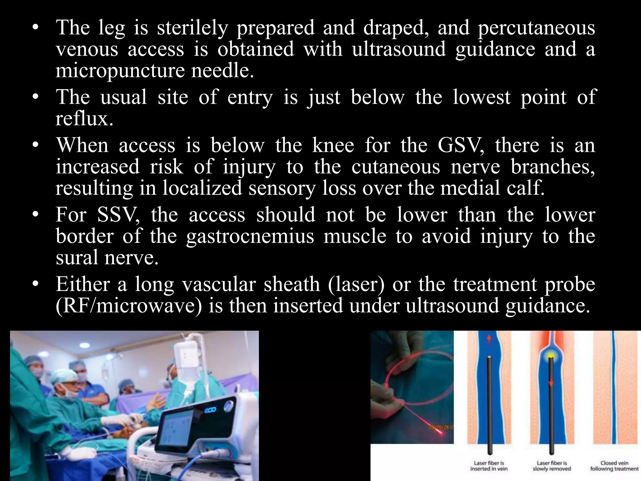 Diagnosis and radiological management of varicose vein | PPTX