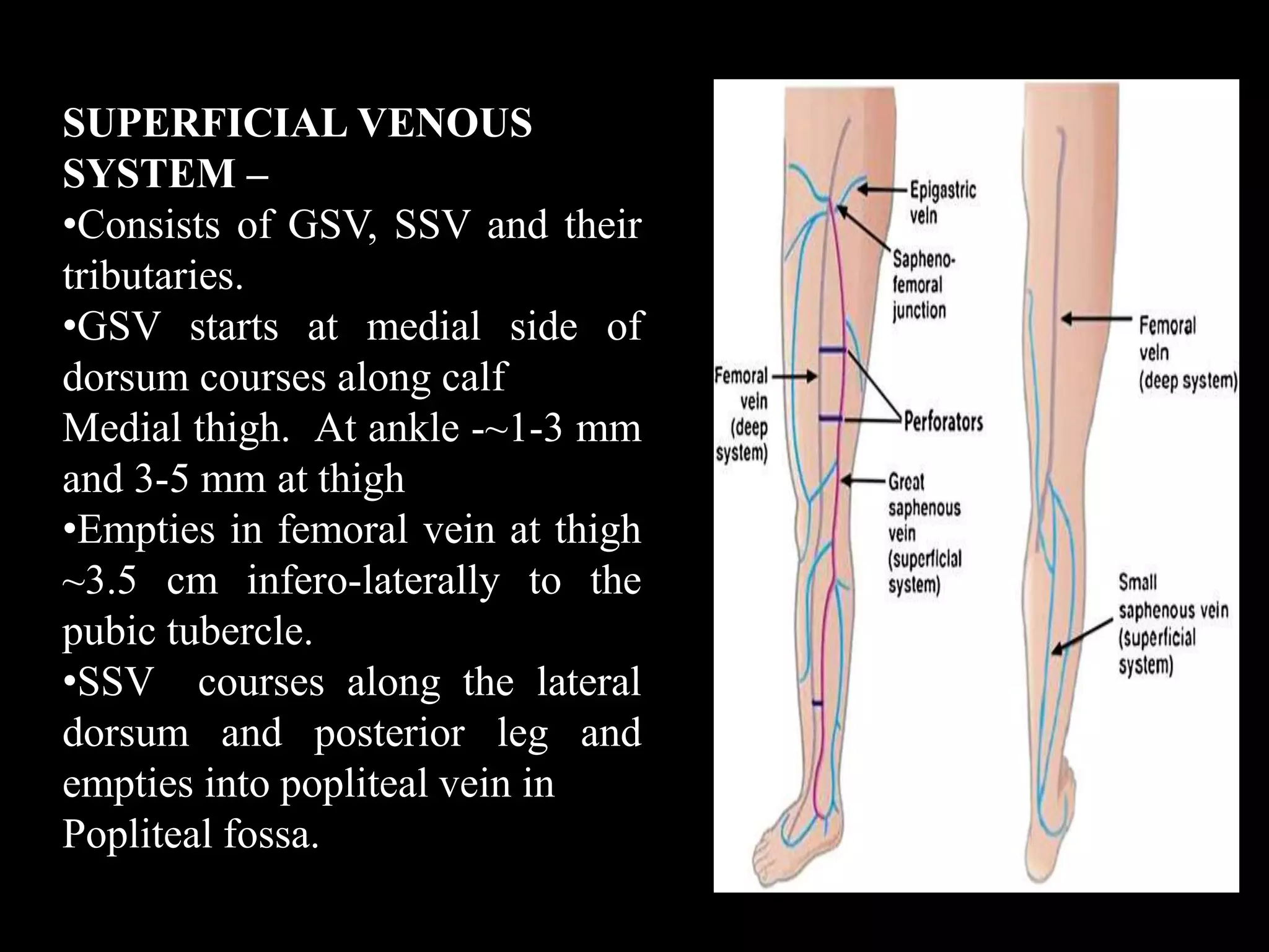 Diagnosis and radiological management of varicose vein | PPTX