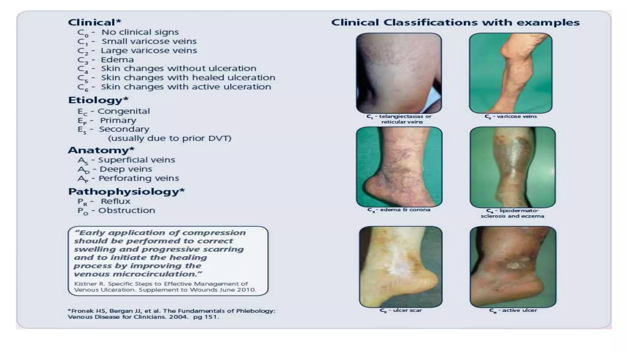 Varicose Veins | PPTX