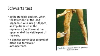 Varicose Veins | PPTX