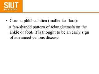 Varicose veins | PPTX