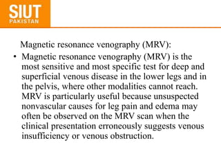 Varicose veins | PPTX