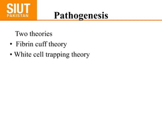 Varicose veins | PPTX