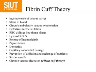 Varicose veins | PPTX