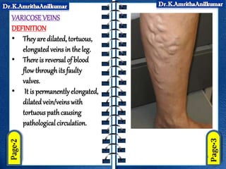 Varicose veins by Dr.AmrithaAnilkumar | PPTX