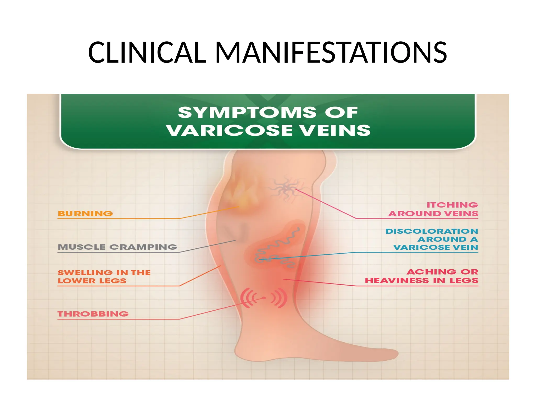 Varicose veins are dilated superficial veins caused by venous hypertension. | PPT