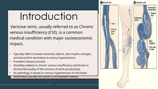 Chronic venous insufficiency (CVI) /Varicose Veins | PPTX
