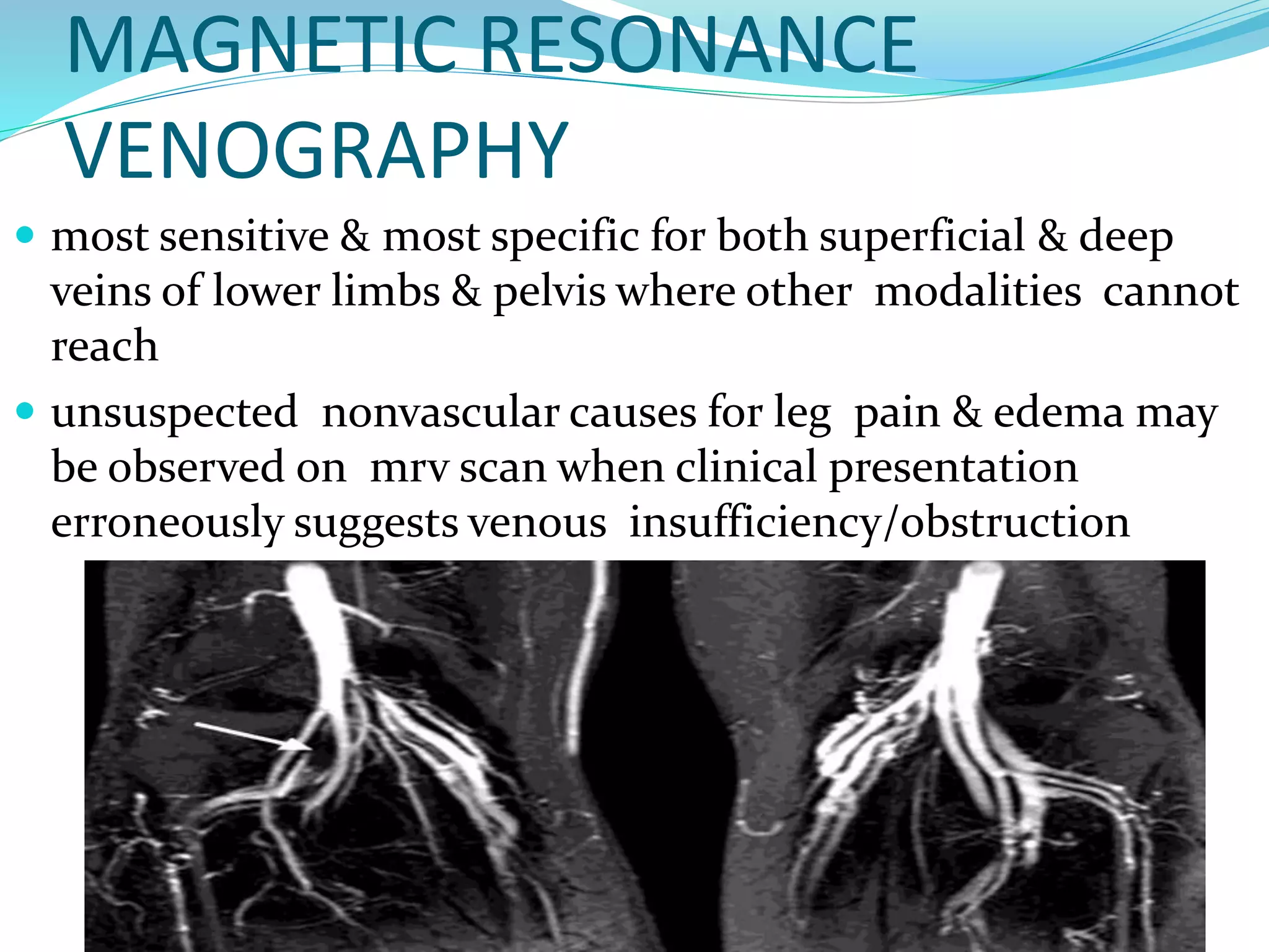 Venous Disorders- gunabhi.ppt