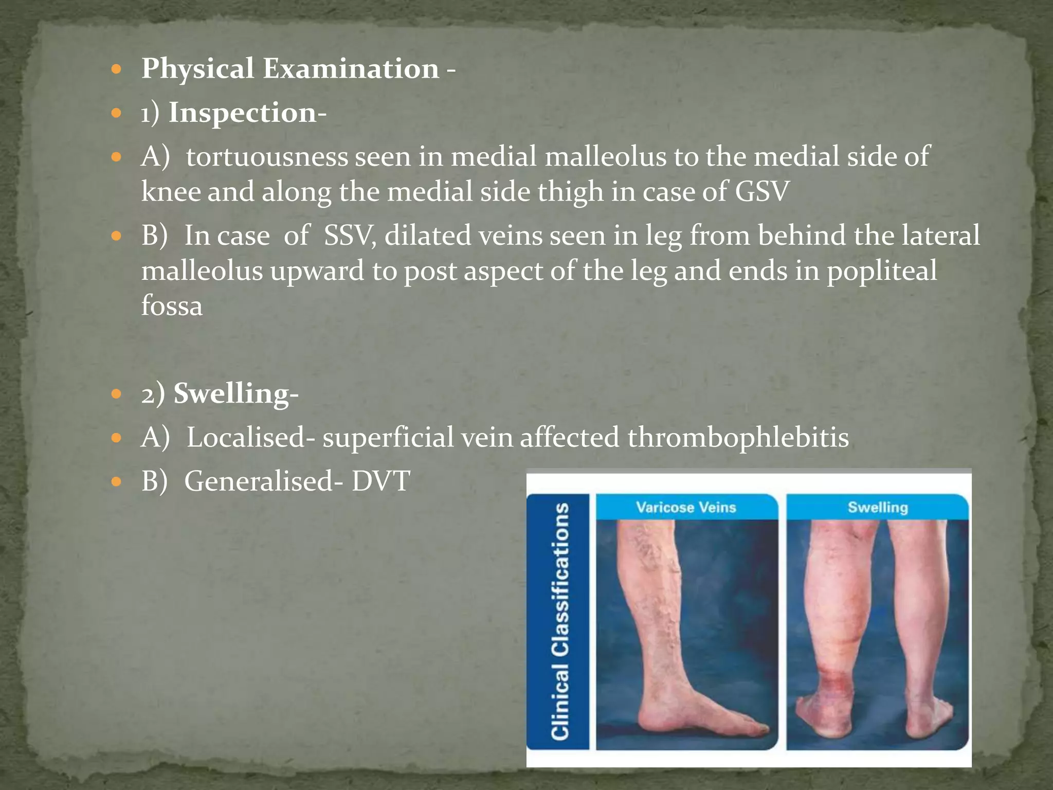 VARICOSE__VEINS Akash Rathod.pptx