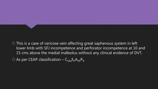 Varicose veins | PPT