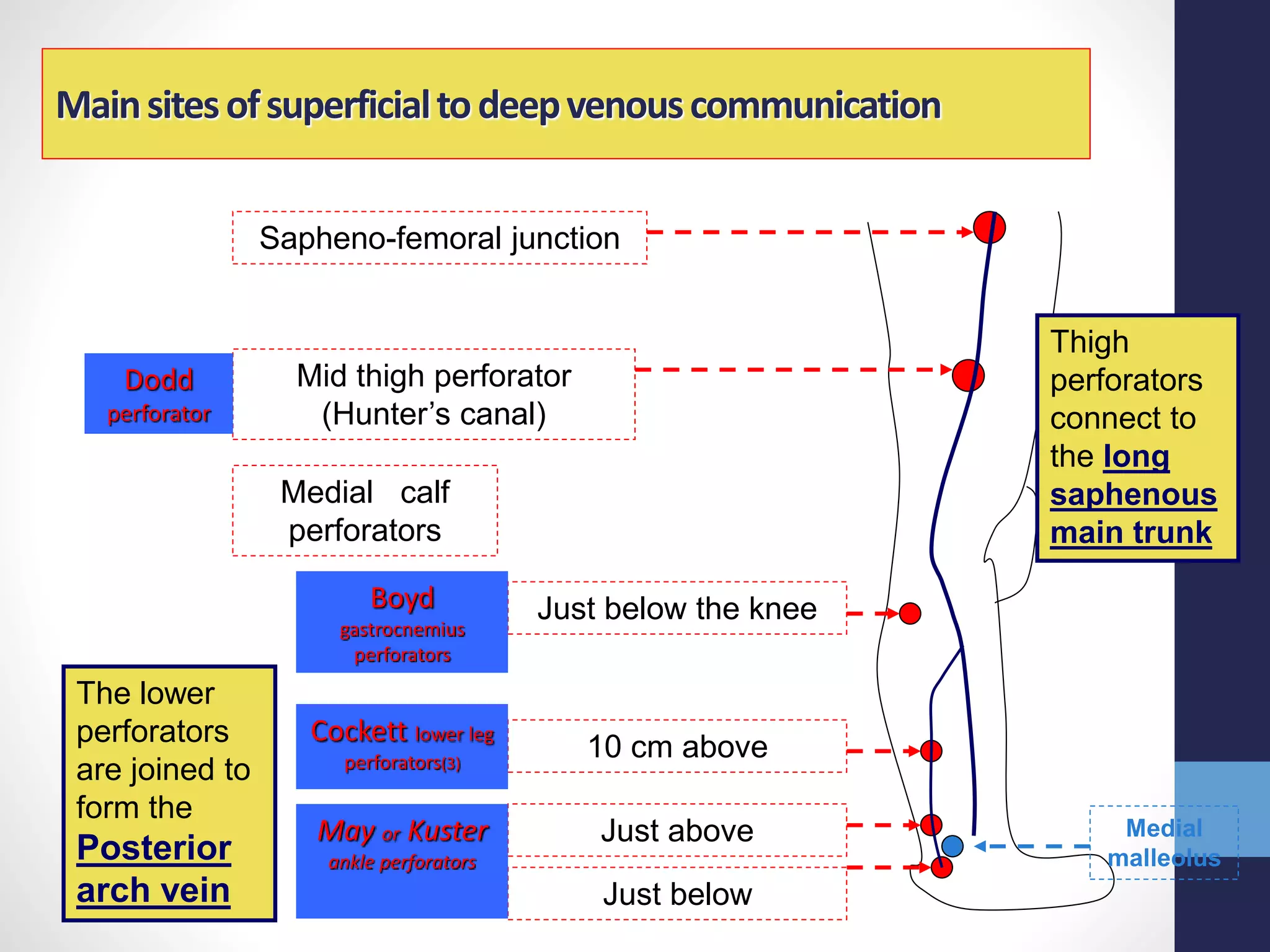 Varicose veins by M.Fathy Zaidan | PPTX