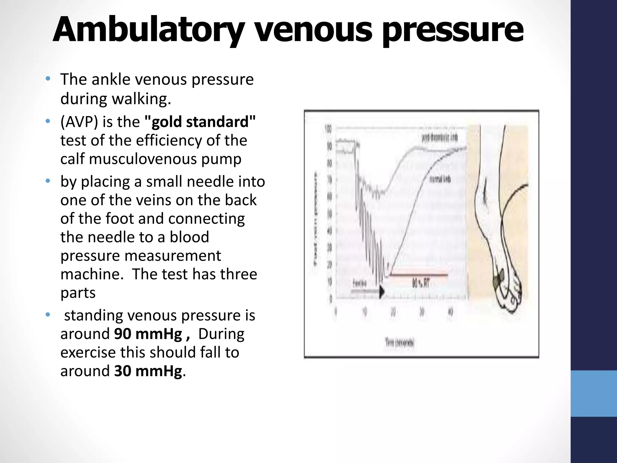 Varicose veins by M.Fathy Zaidan | PPTX