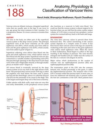 Anatomy, Physiology & Classification of Varicose Veins | PDF