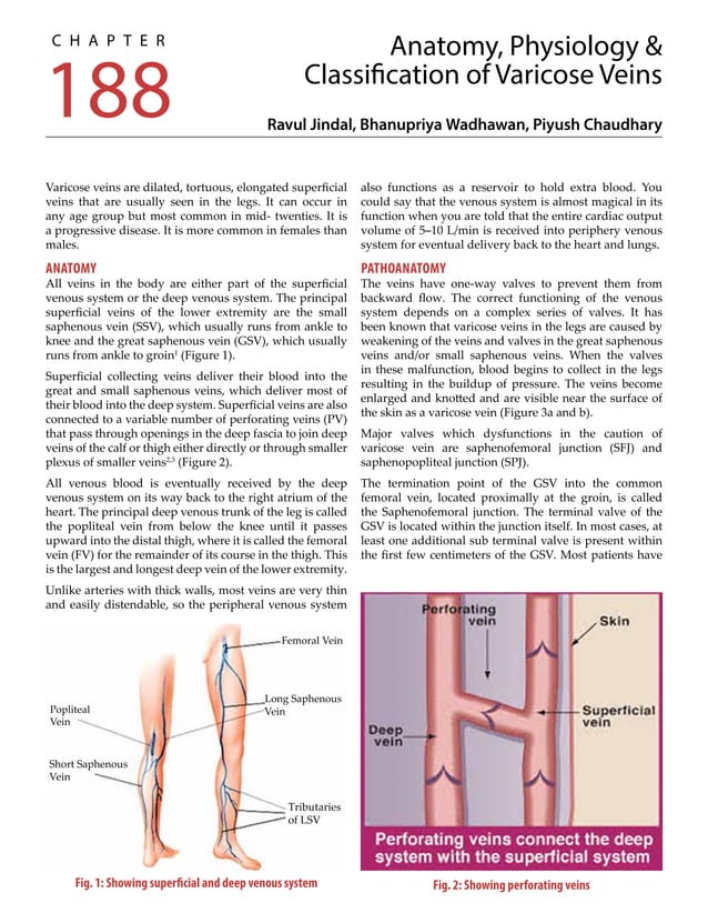 Anatomy, Physiology & Classification of Varicose Veins | PDF