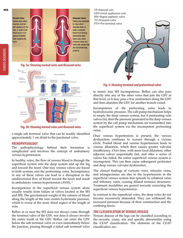 Anatomy Physiology And Classification Of Varicose Veins
