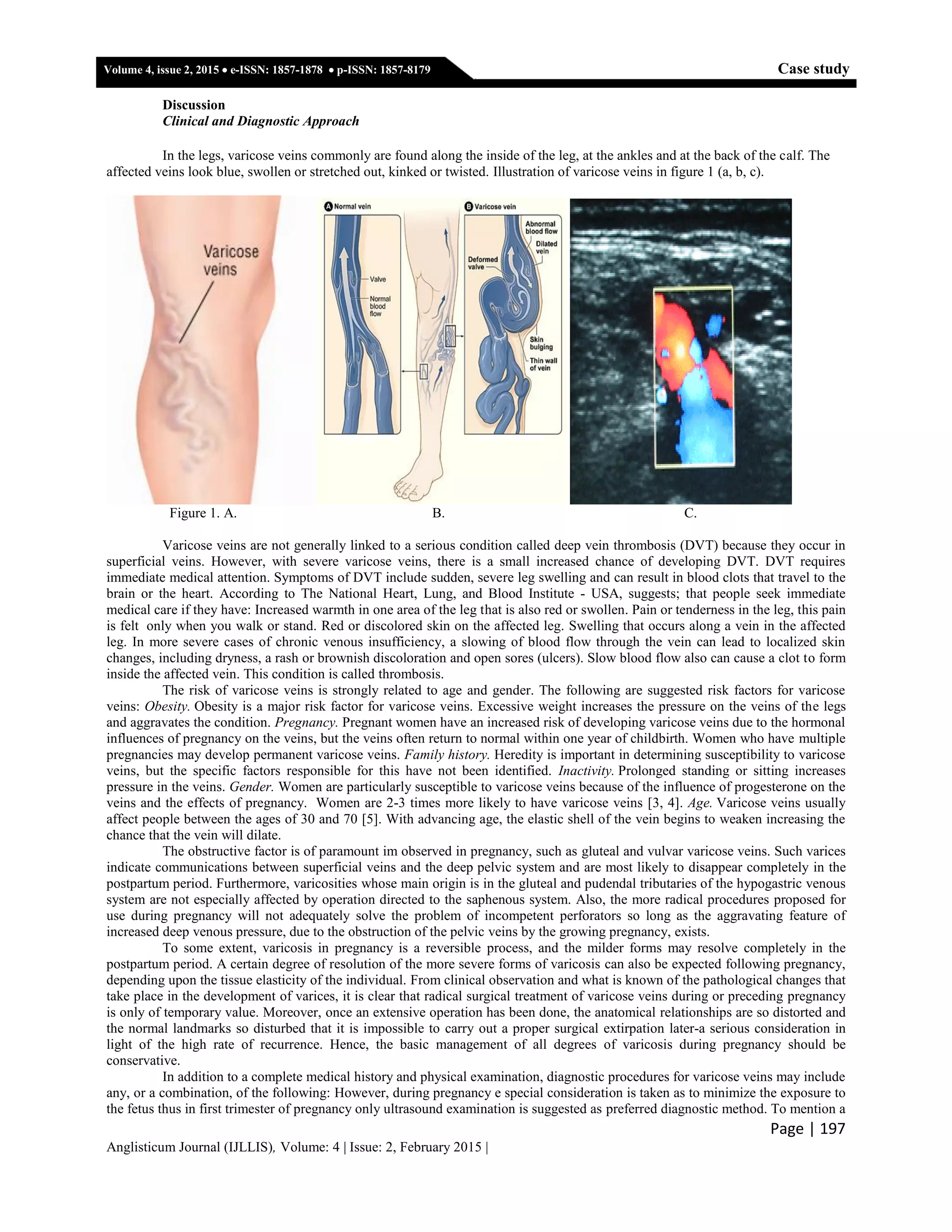 Varicose veins during pregnancy, diagnosis, and treatment | PDF