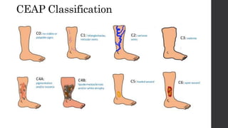 ecture.pptx | Blood Disorders | Diseases and Conditions