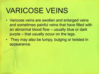 VARICOSE VEINS MRB-1.pptx