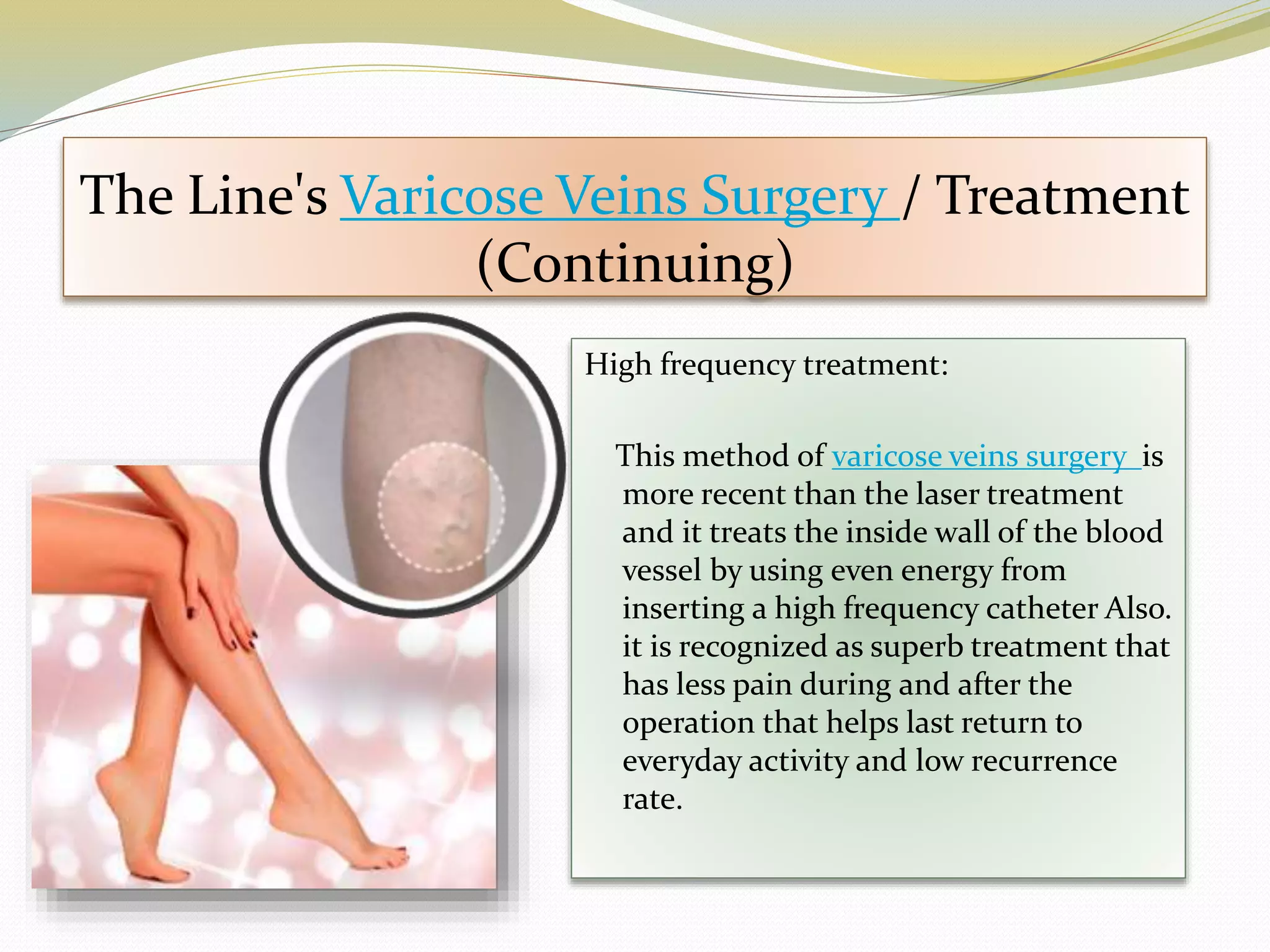 Varicose Veins Surgery | PPTX