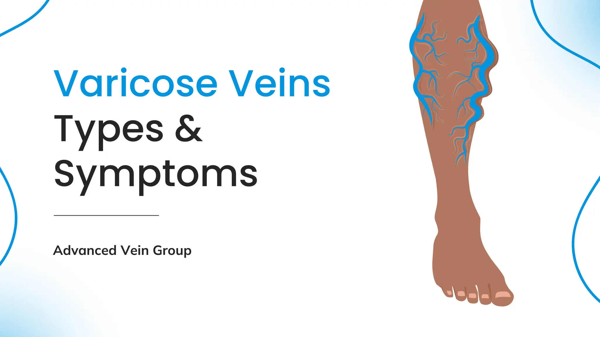 Varicose Veins Types & Symptoms | PPT