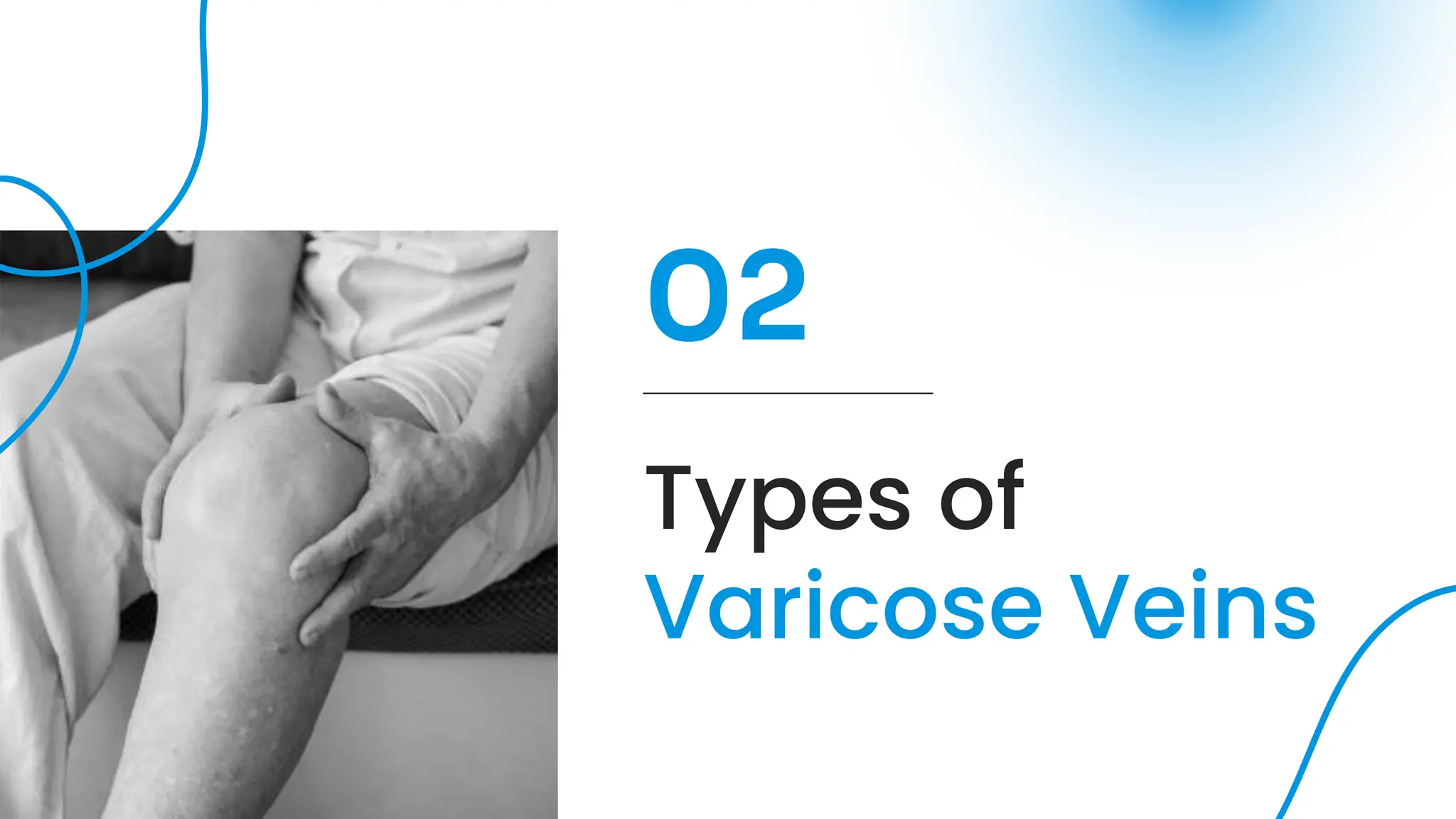 Varicose Veins Types & Symptoms | PPTX