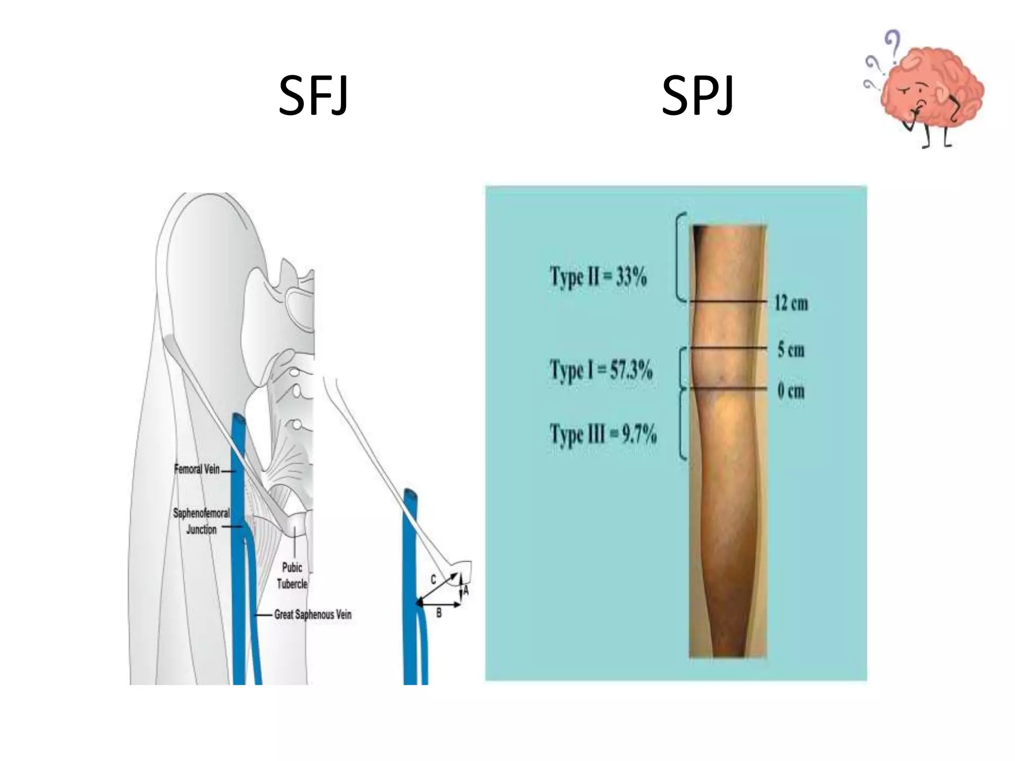 Varicose vein, Venous ulcer.pptx