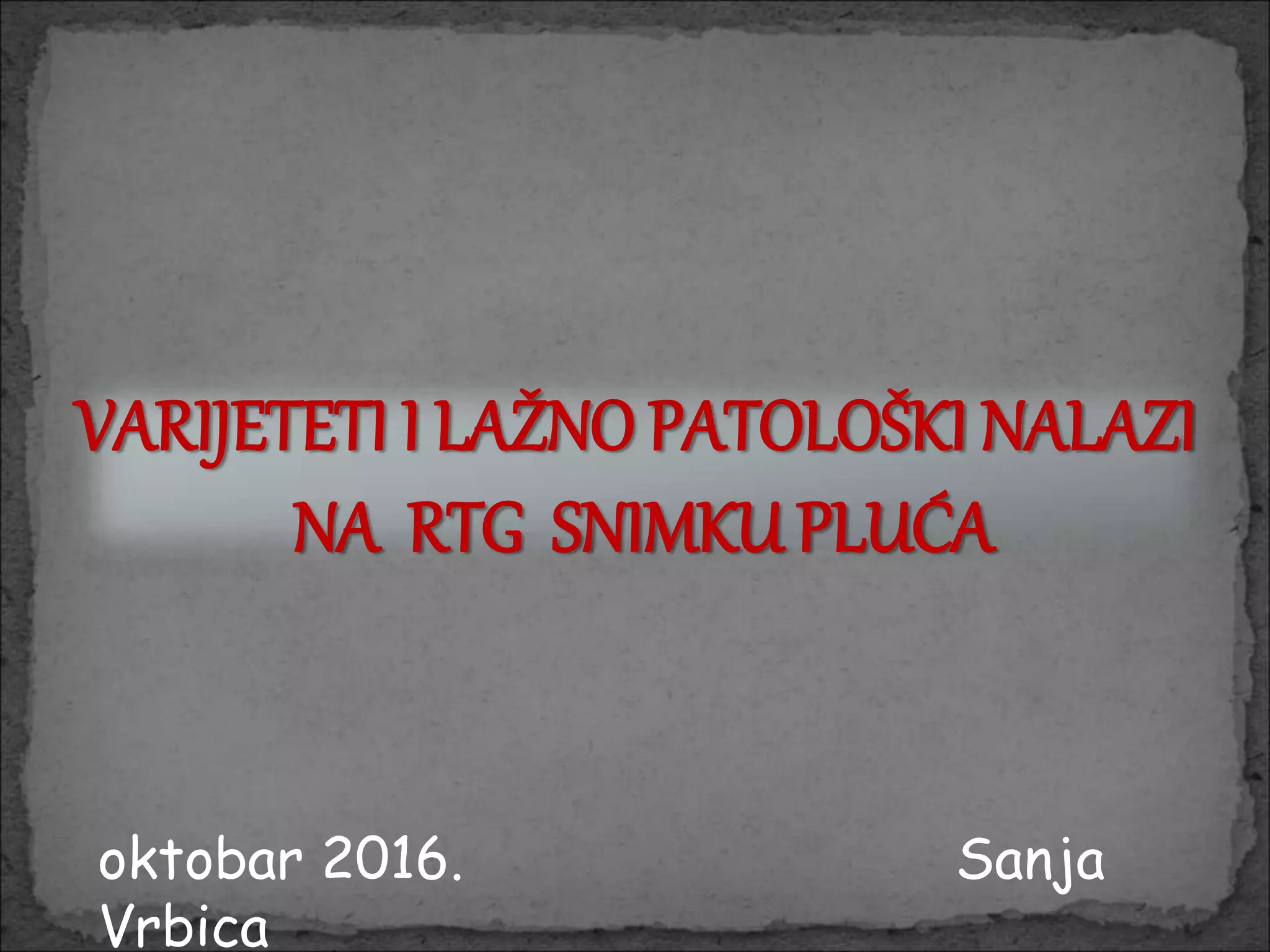 Varijeteti i lazno patoloski nalazi na RTG snimku pluca | PPTX