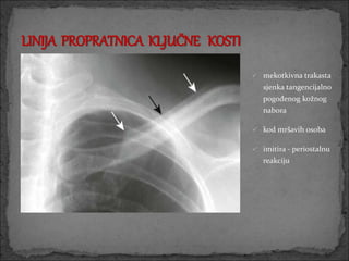 Varijeteti i lazno patoloski nalazi na RTG snimku pluca | PPTX