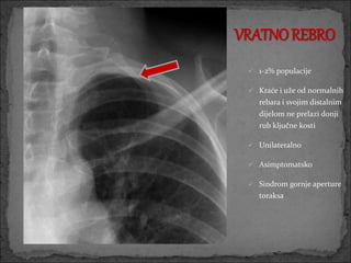 Varijeteti i lazno patoloski nalazi na RTG snimku pluca | PPTX