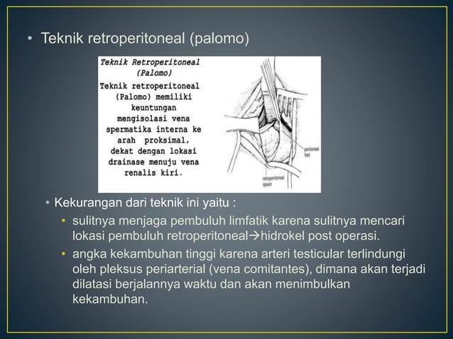 Varikokel bilateral | PPTX