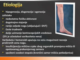 Varikozne vene | PPSX