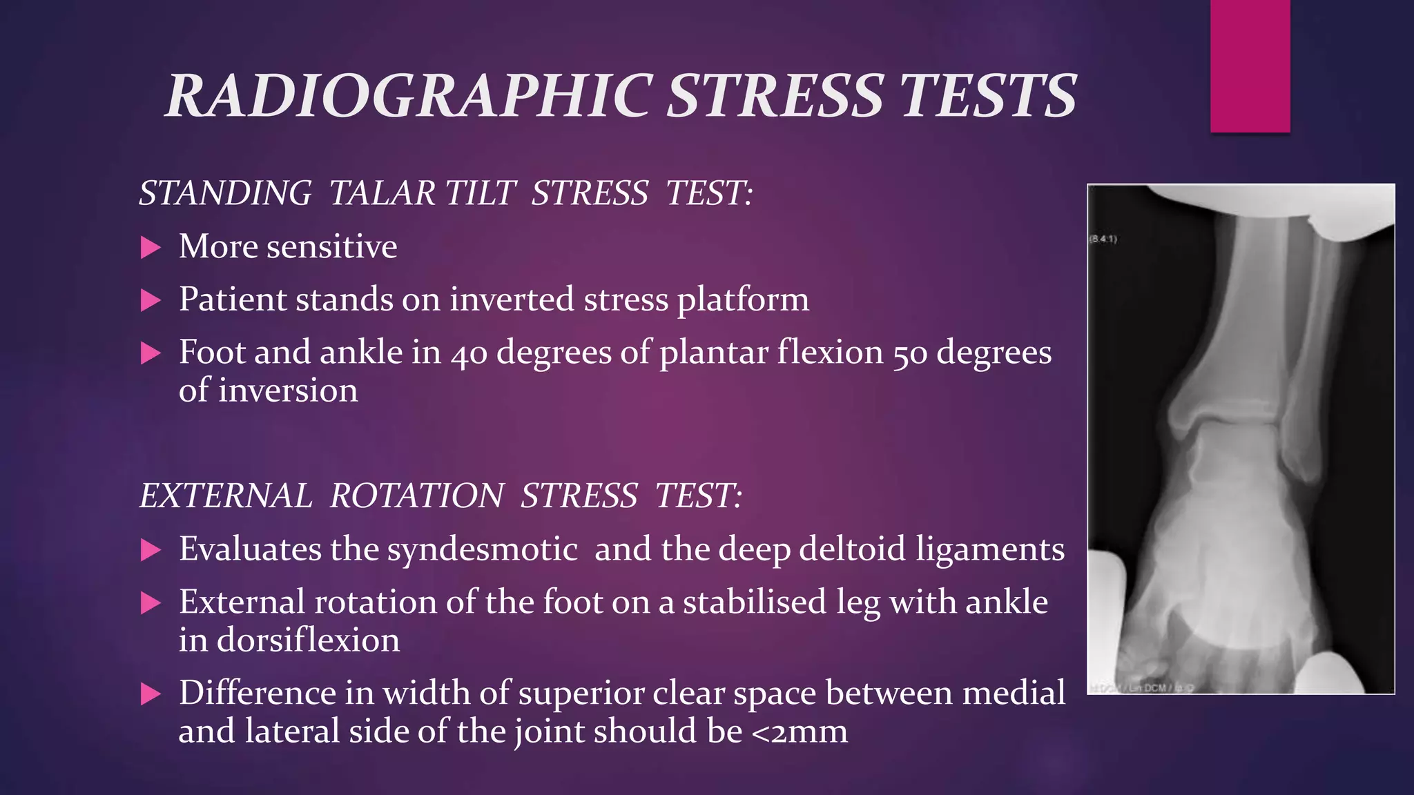 Various ankle injuries and it’s management | PPTX