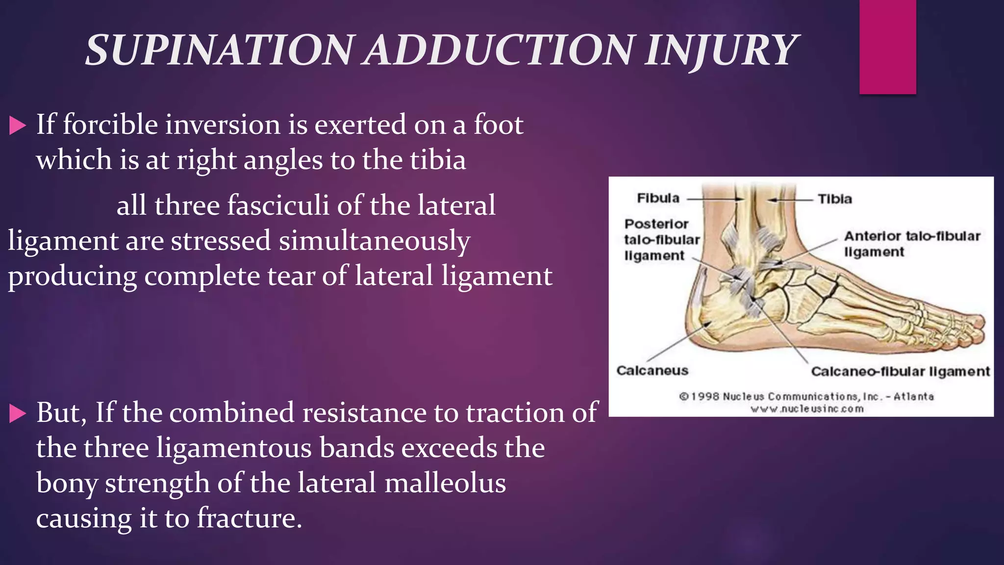 Various ankle injuries and it’s management | PPTX