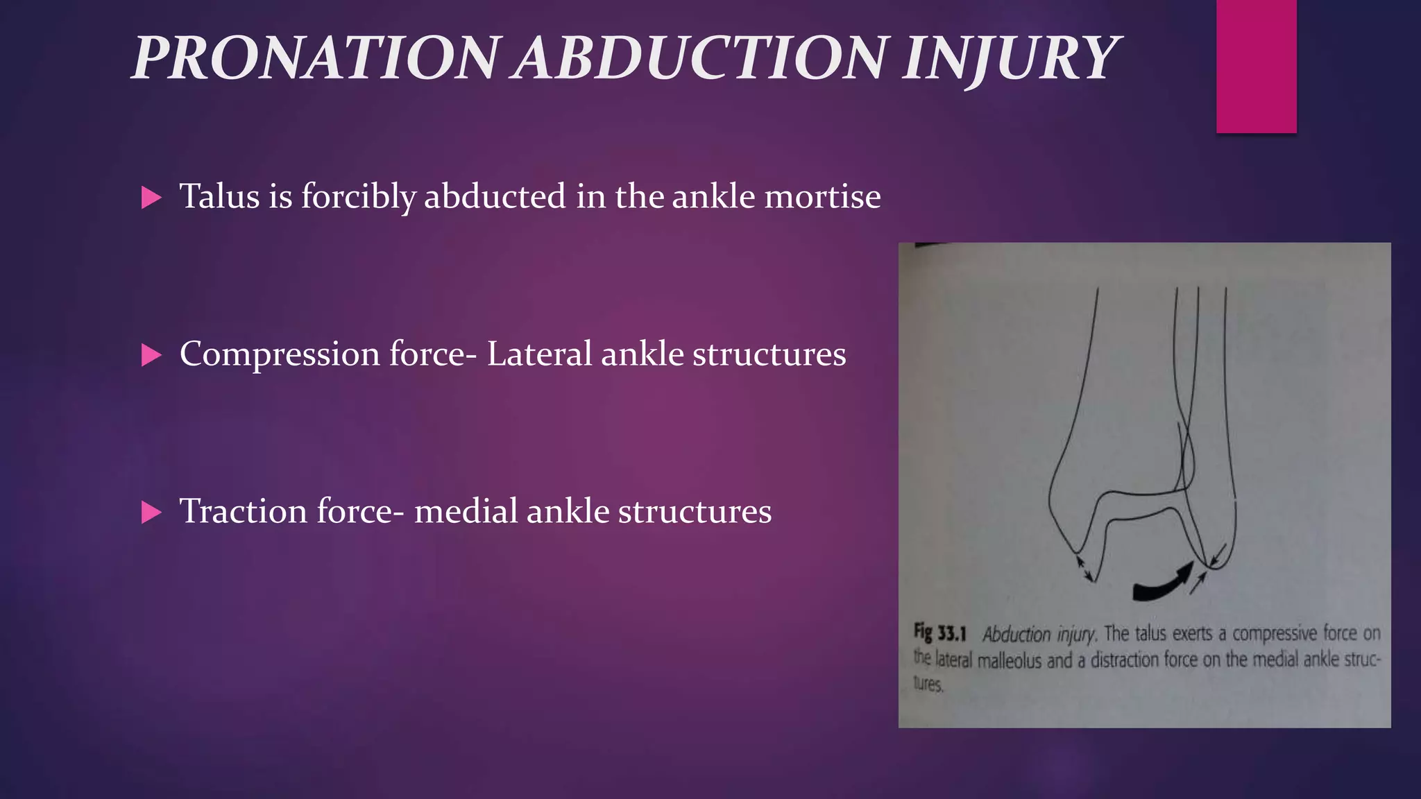 Various ankle injuries and it’s management | PPTX