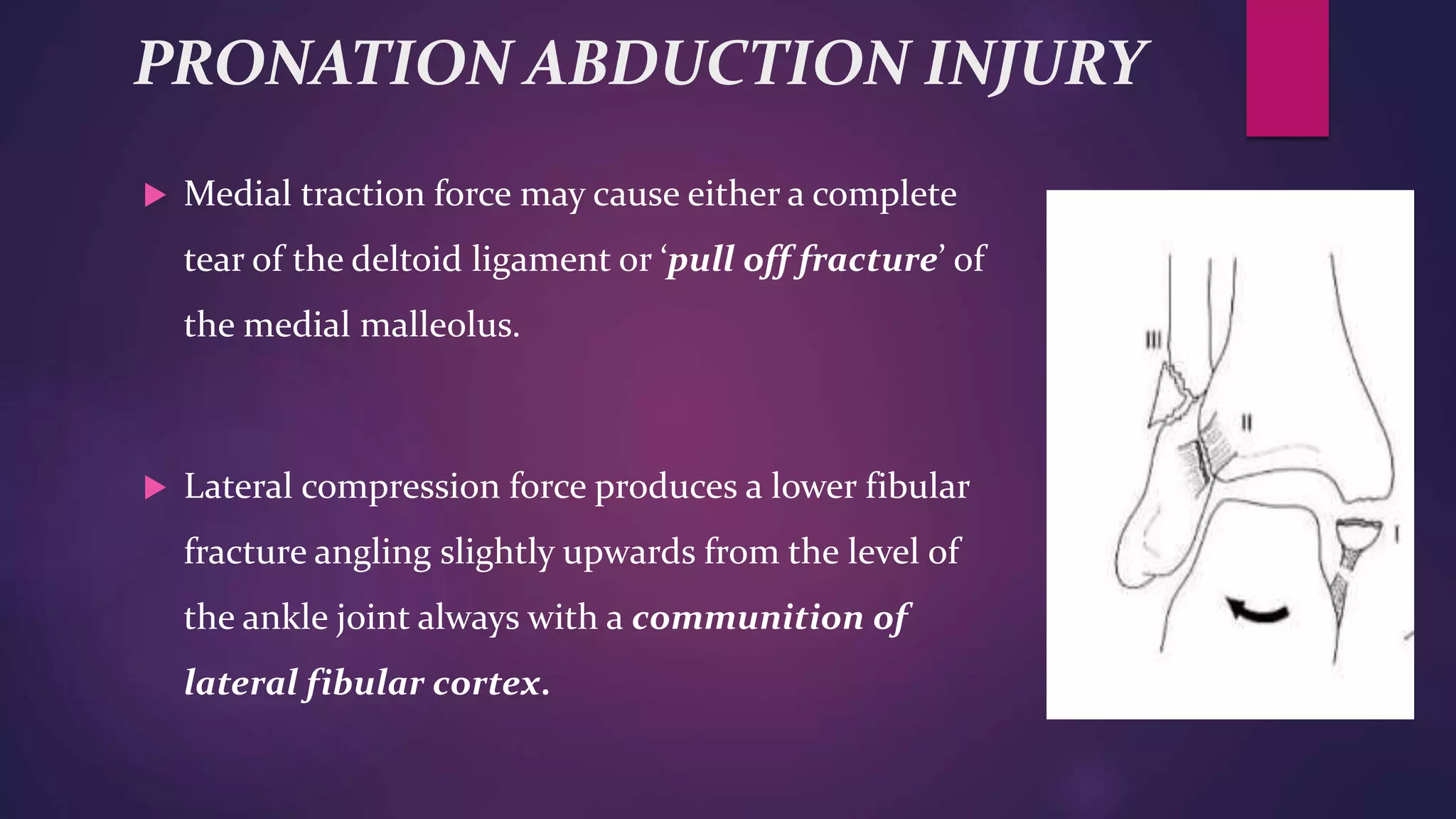 Various ankle injuries and it’s management | PPTX