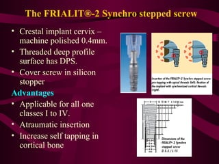 Various implant systems in india final | PPT