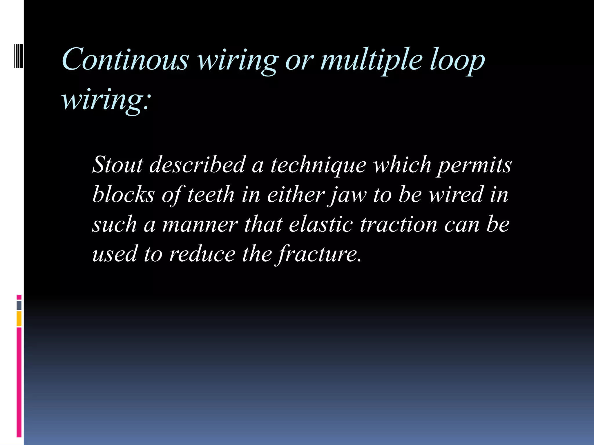 Various intermaxillary fixation techniques | PPTX