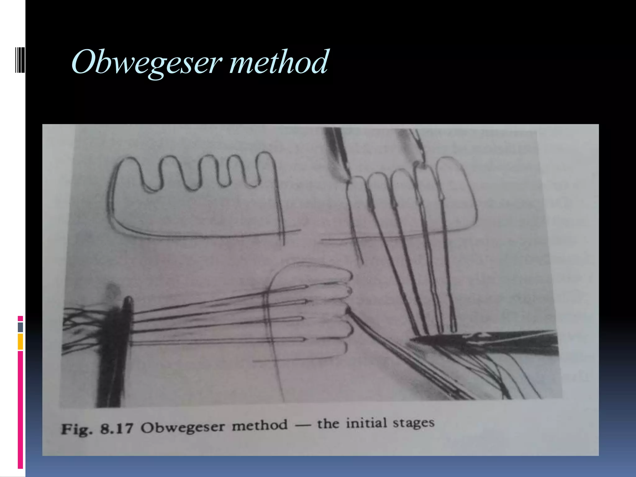 Various intermaxillary fixation techniques | PPTX
