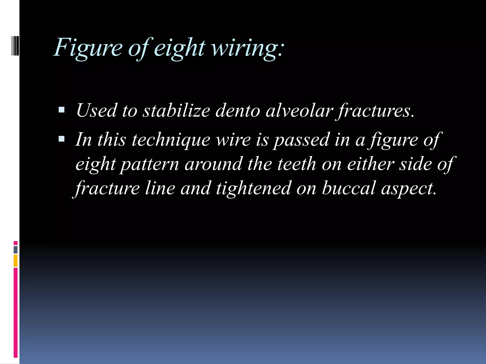 Various intermaxillary fixation techniques | PPTX
