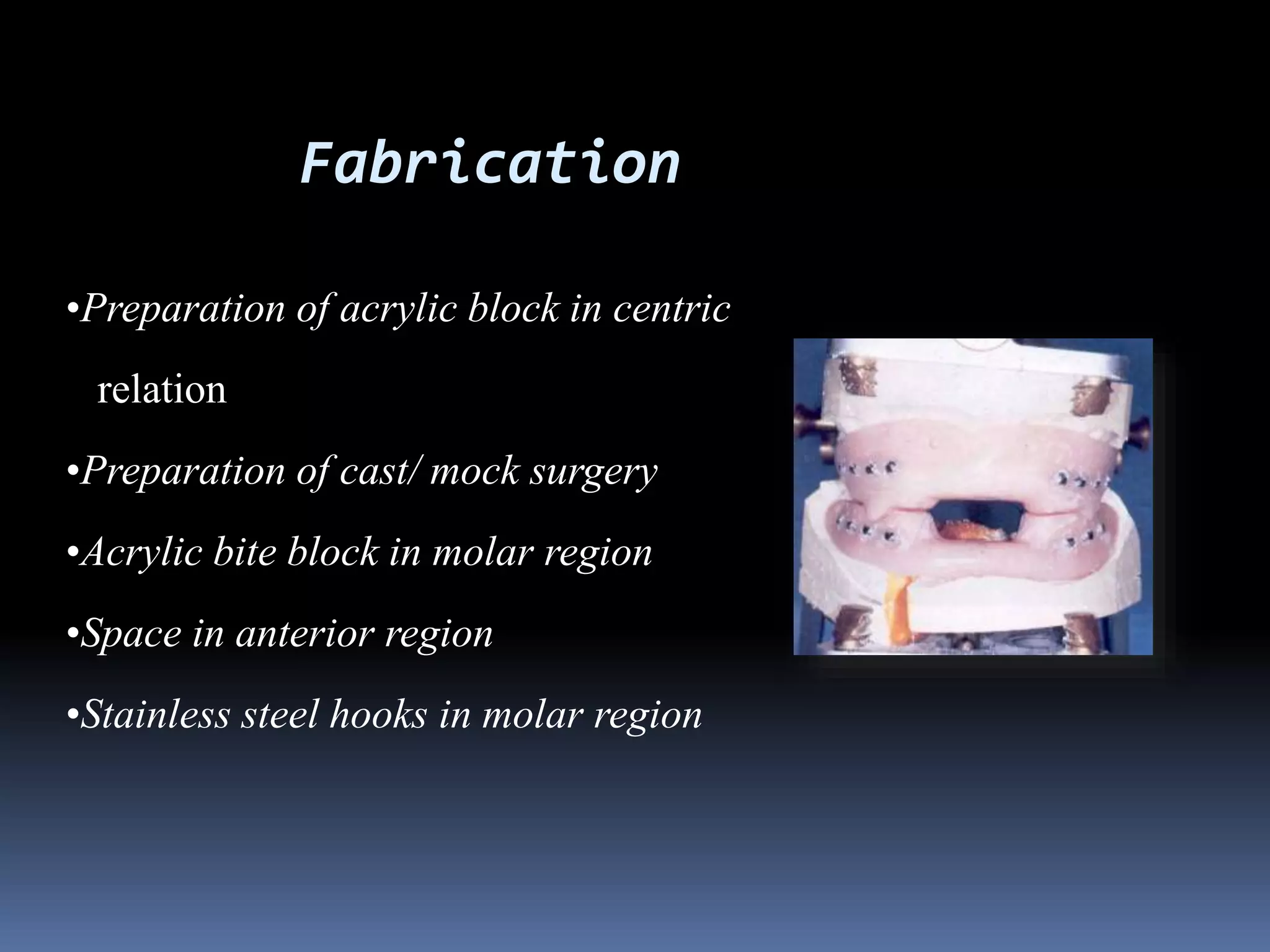 Various intermaxillary fixation techniques | PPTX