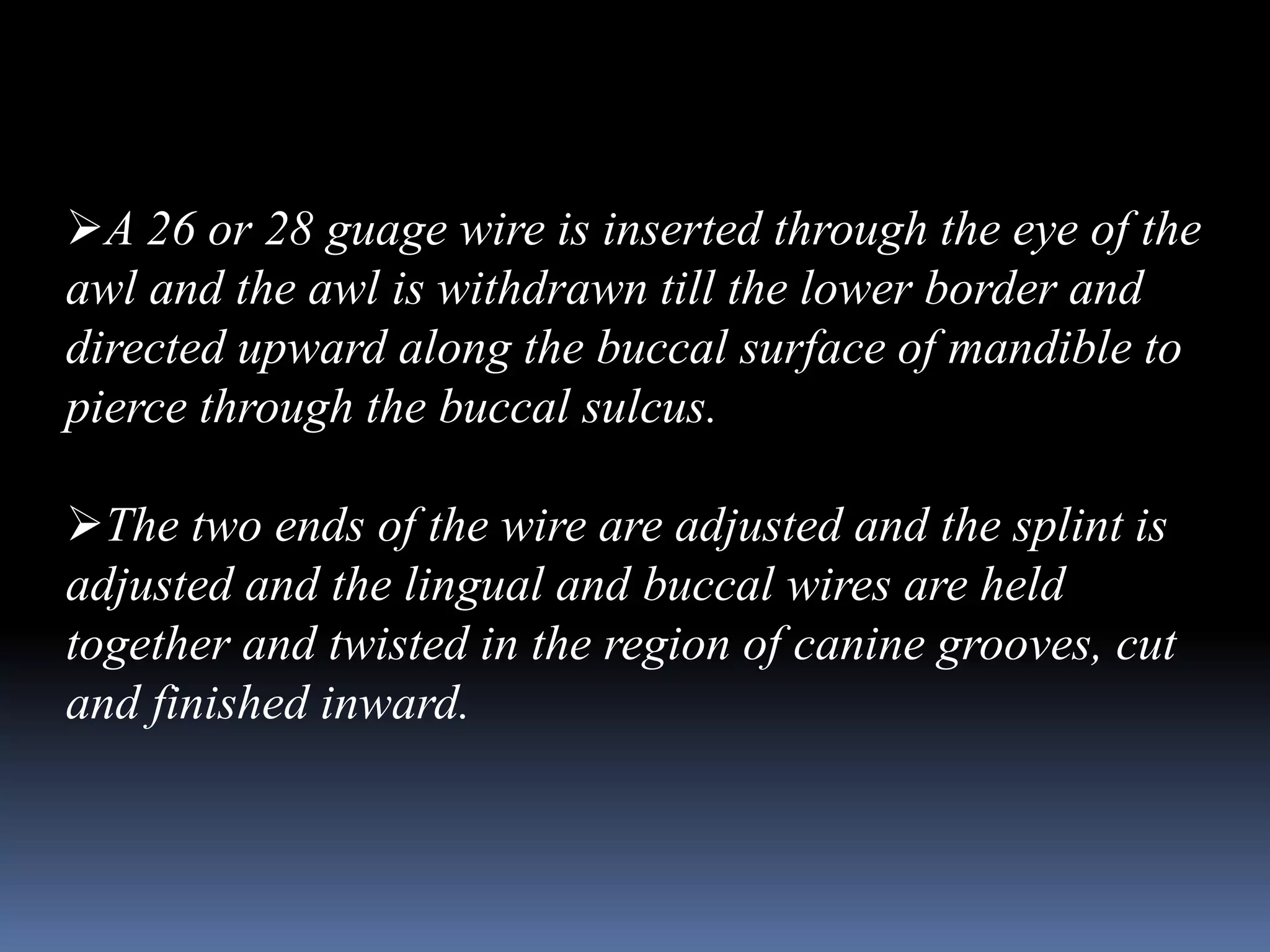 Various intermaxillary fixation techniques | PPTX