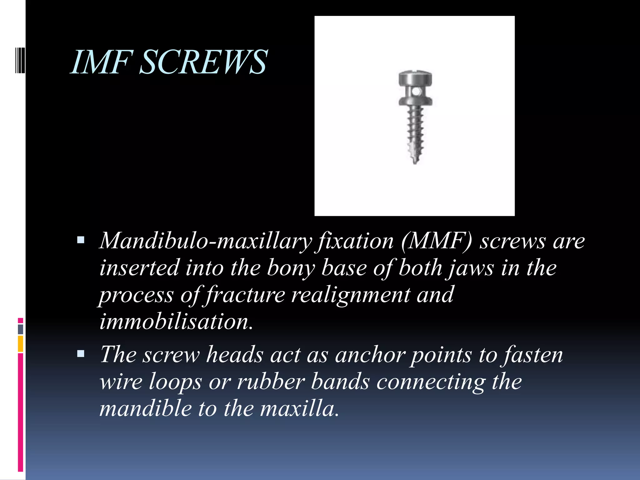 Various intermaxillary fixation techniques | PPTX