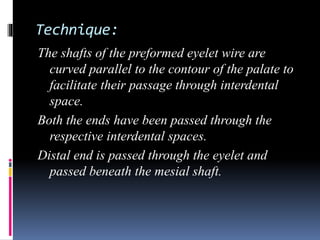 Various intermaxillary fixation techniques | PPTX