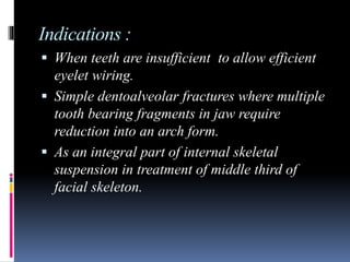 Various intermaxillary fixation techniques | PPTX