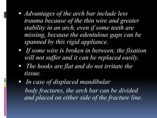 Various intermaxillary fixation techniques | PPTX